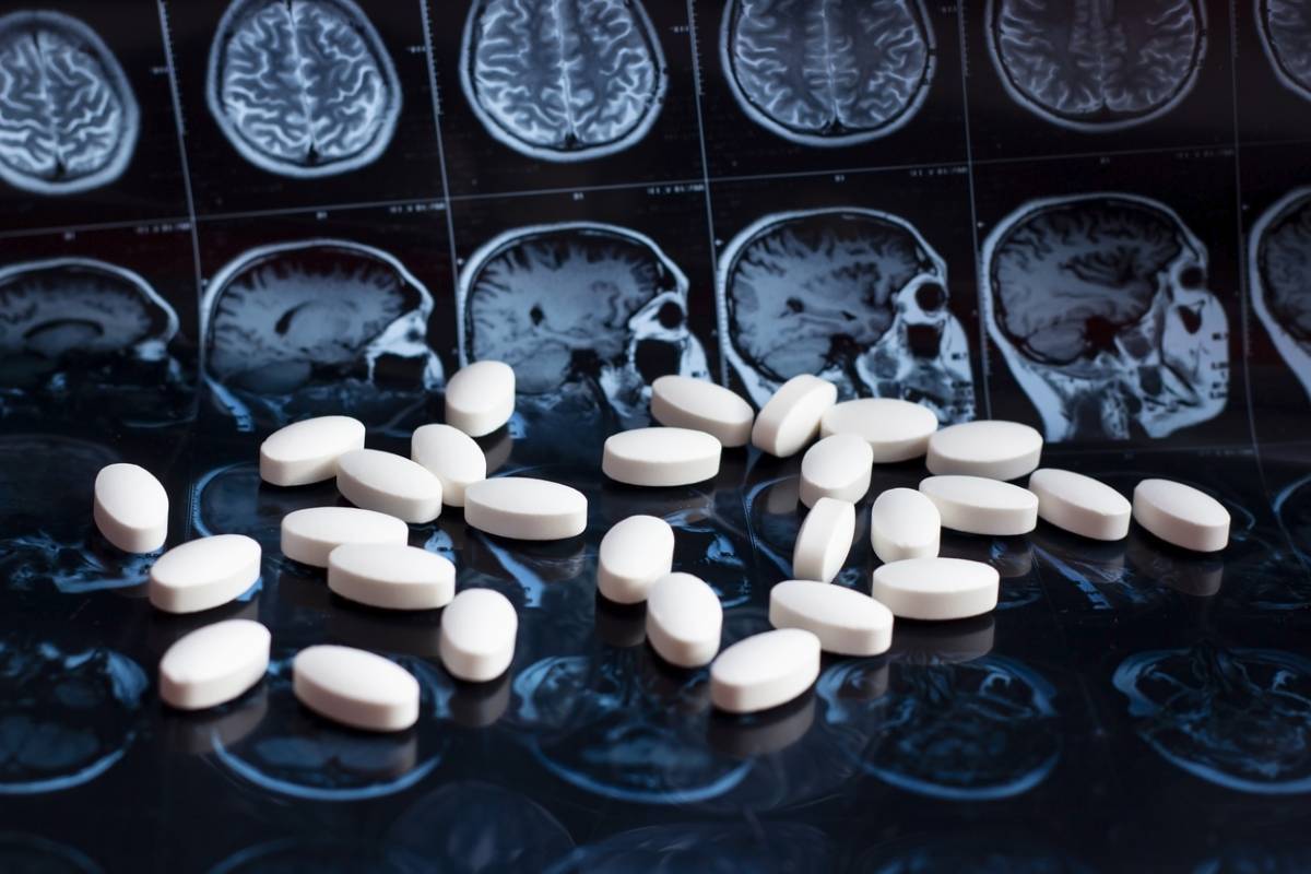 Cerveau et drogues : quel impact à court et moyen terme